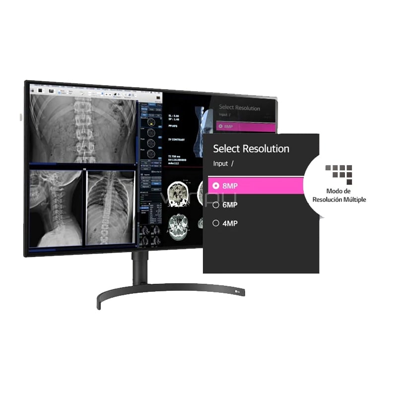 Monitor de Diagnóstico LG de 32“ - 32HL512D-B.AWH - Winpy.cl